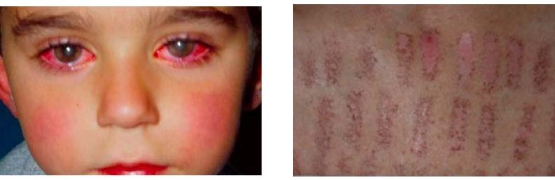 OLSEH – IISc Bangalore